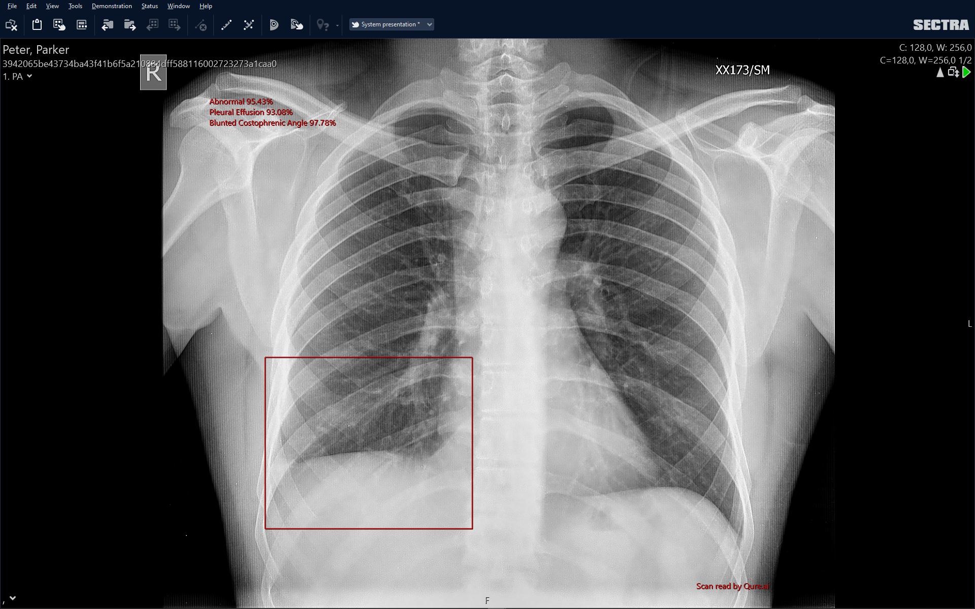 qXR | Sectra Global E-learning